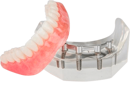 Cost of Snap on Dentures in Mexico | 4,200 USD | Same-Day Teeth